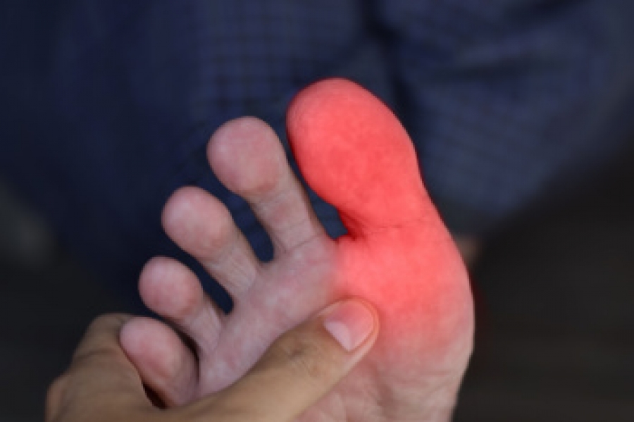 Causes and Symptoms of Toe Burning Sensation